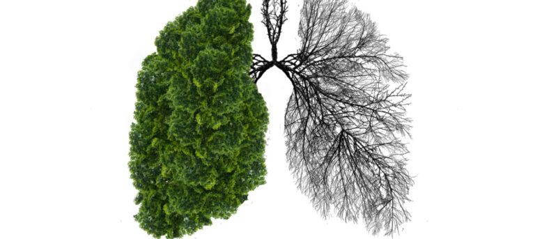 Russian Man Makes Medical History: Tree Found Growing in His Lung ...