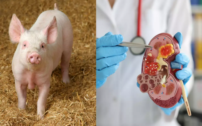 Pigs Emerge as Viable Answer to Organ Shortage Crisis