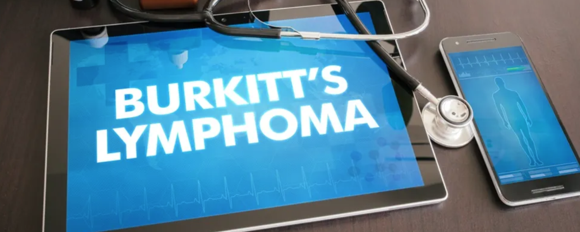 A Case of Gastric Burkitt Lymphoma in HIV/AIDS